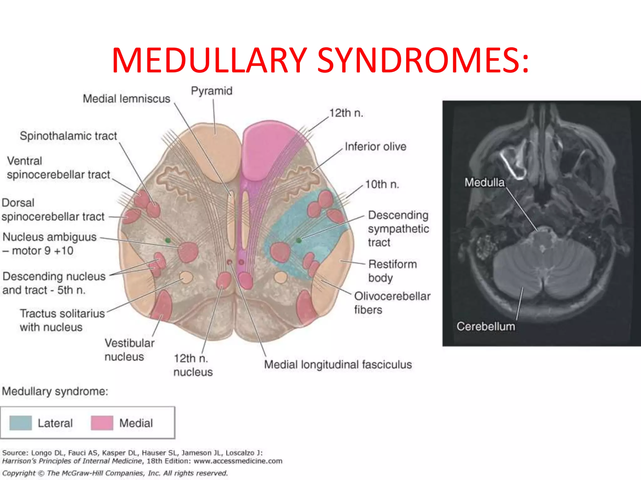 Anatomy of brainstem and its clinical significance | PPTX