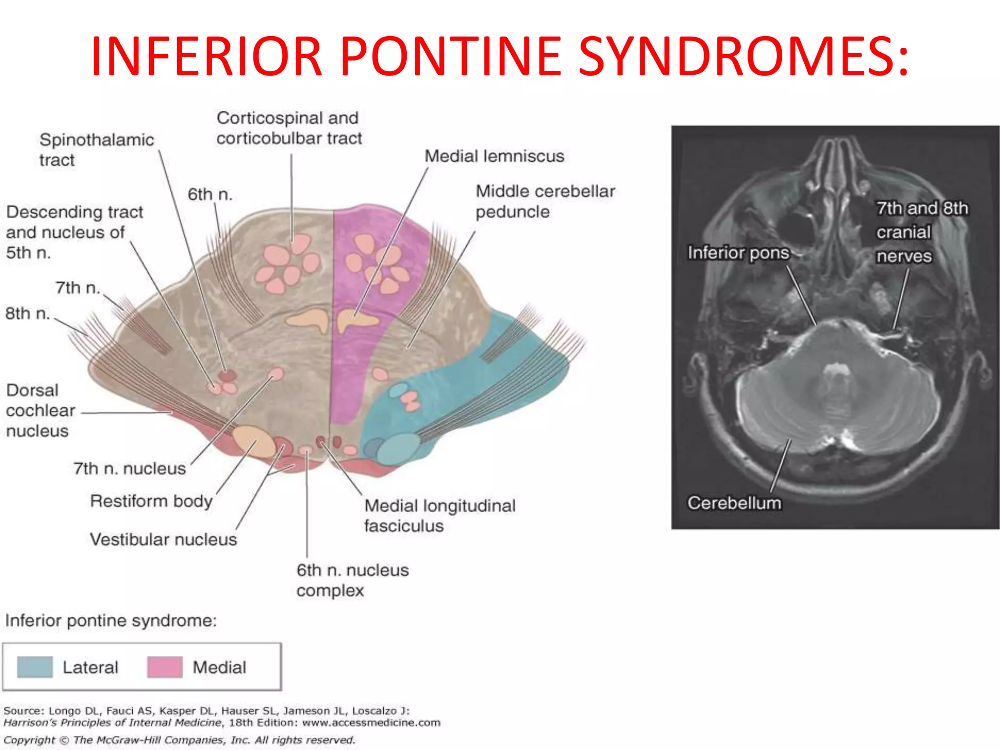 Anatomy of brainstem and its clinical significance | PPTX