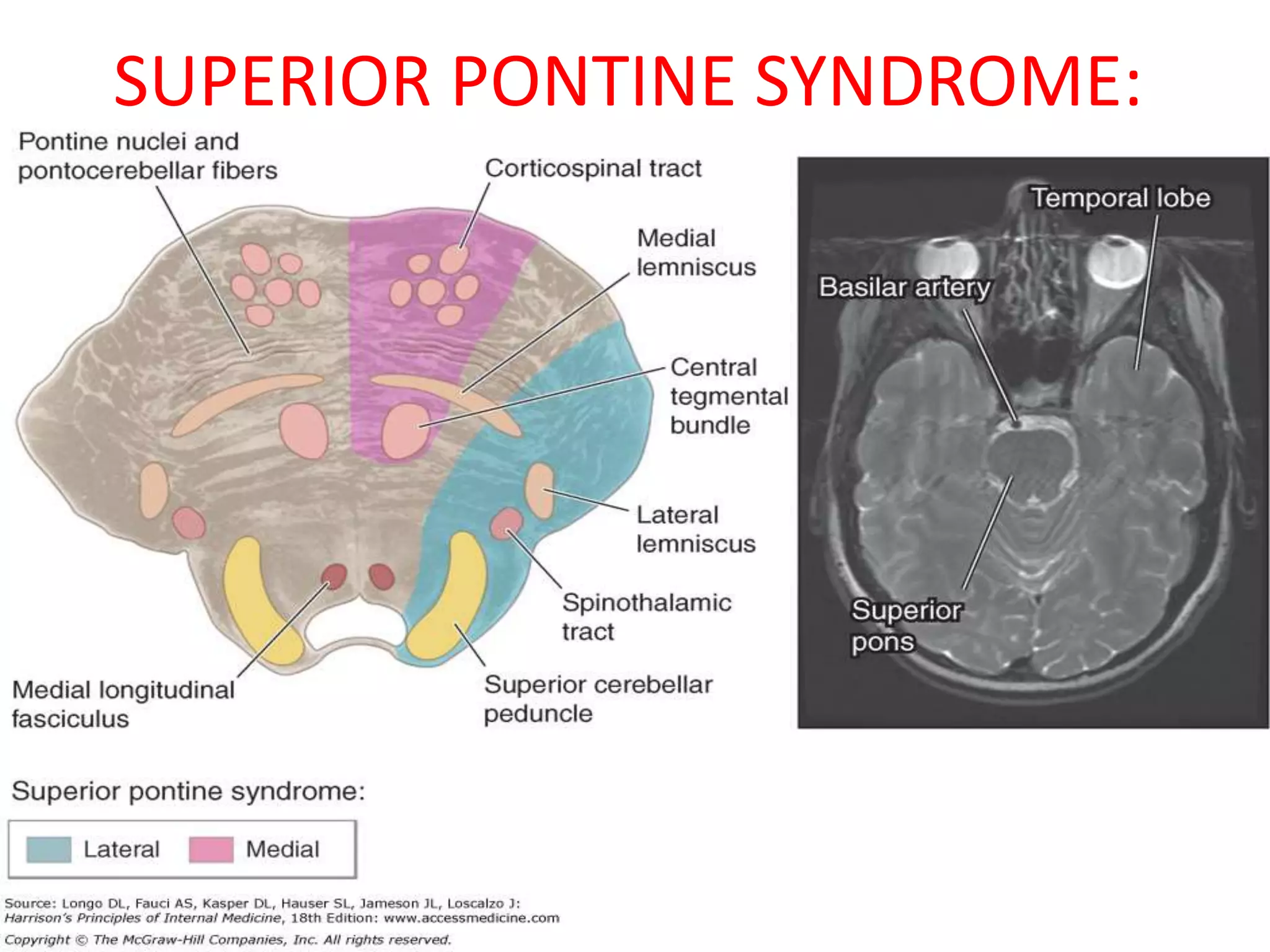 Anatomy of brainstem and its clinical significance | PPTX