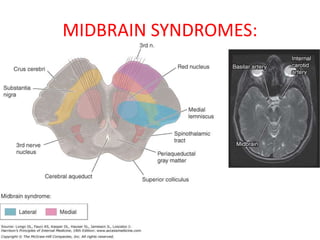 Anatomy of brainstem and its clinical significance | PPTX