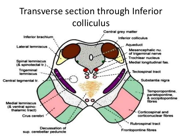 Anatomy of brainstem and its clinical significance