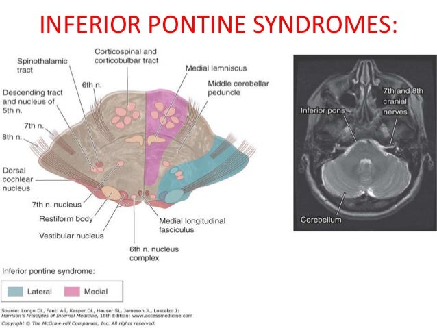 Anatomy of brainstem and its clinical significance