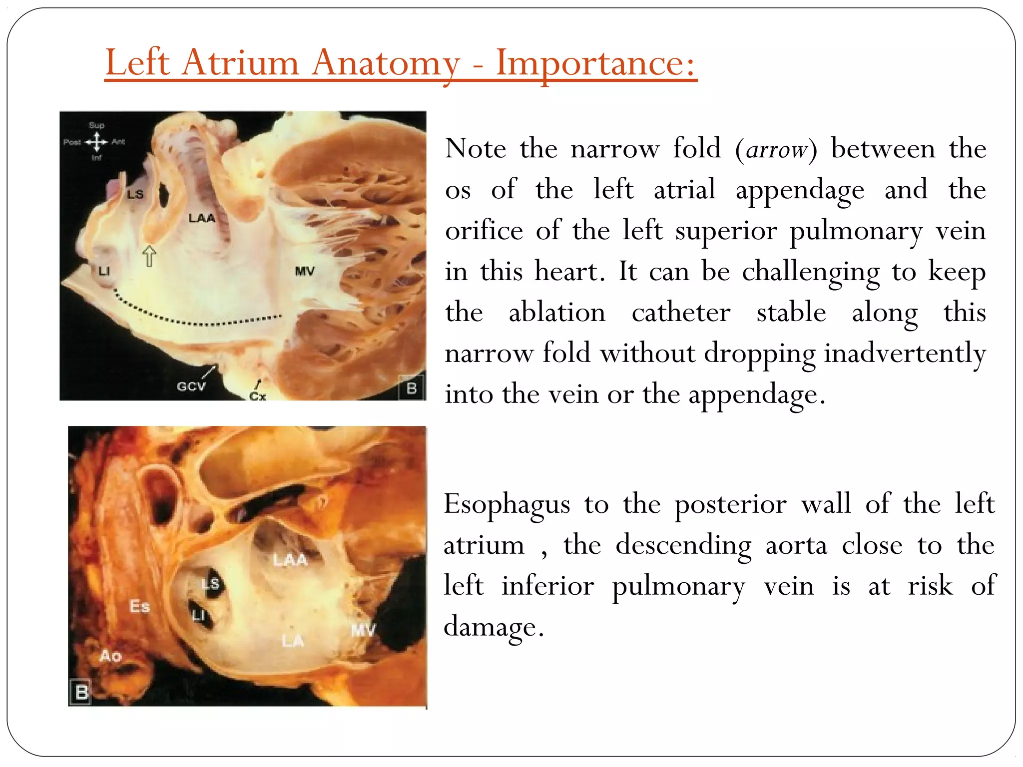 Anatomy of cardiac structures & conducting system in | PPT