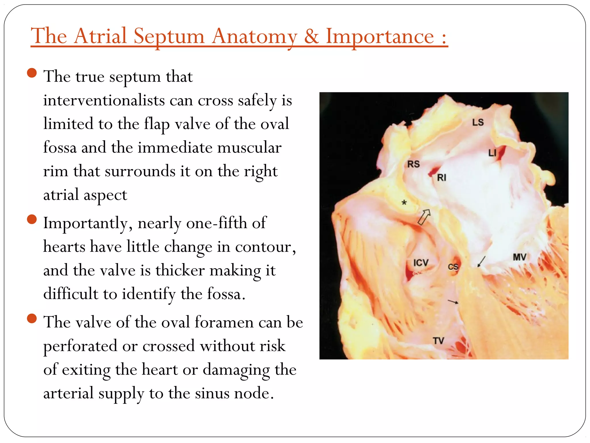 Anatomy of cardiac structures & conducting system in | PPT