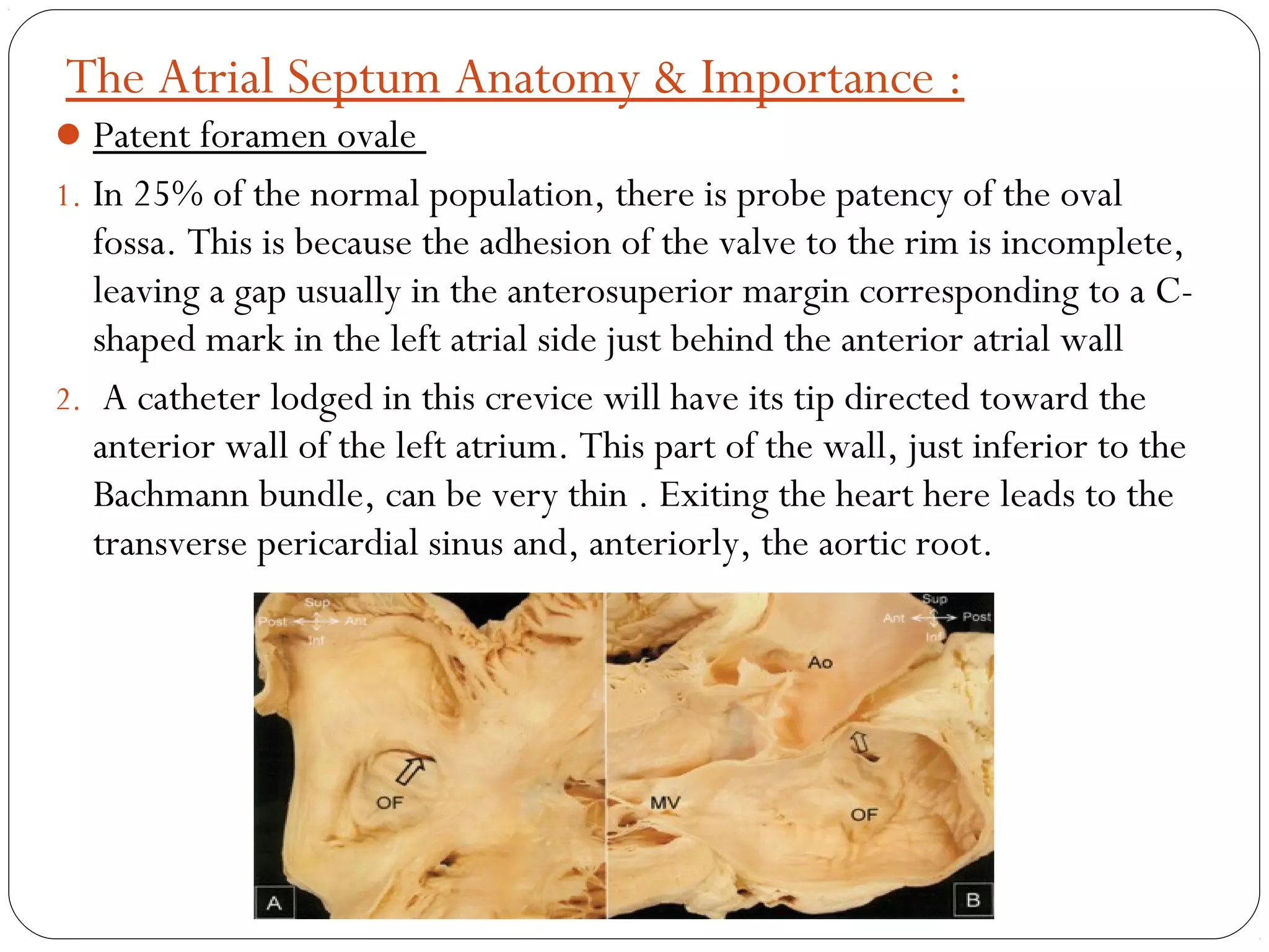 Anatomy of cardiac structures & conducting system in | PPT