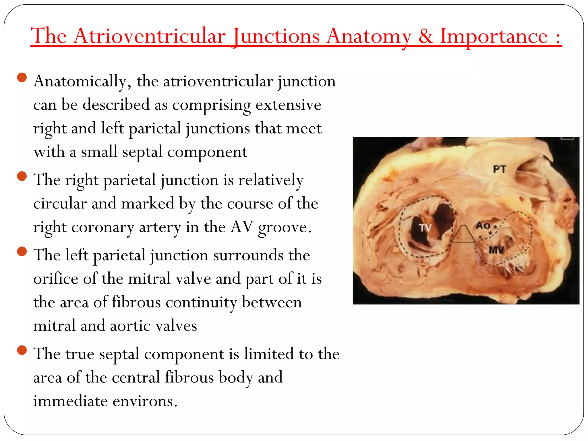 Anatomy of cardiac structures & conducting system in | PPT