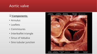 Anatomy of Cardiac Valves.pptx1234123412 | PPT