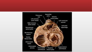 Anatomy of Cardiac Valves.pptx1234123412 | PPT