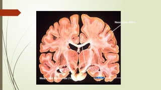 ANATOMY OF CEREBRAL CORTEX LEVY MWANAWASA MEDICAL UNIVERSITY | PPT
