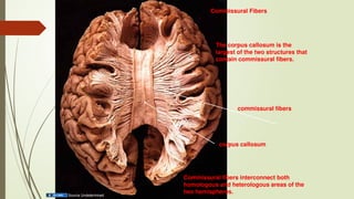 ANATOMY OF CEREBRAL CORTEX LEVY MWANAWASA MEDICAL UNIVERSITY | PPT