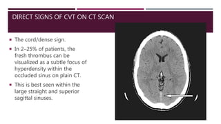 Anatomy of cerebral veins | PPTX