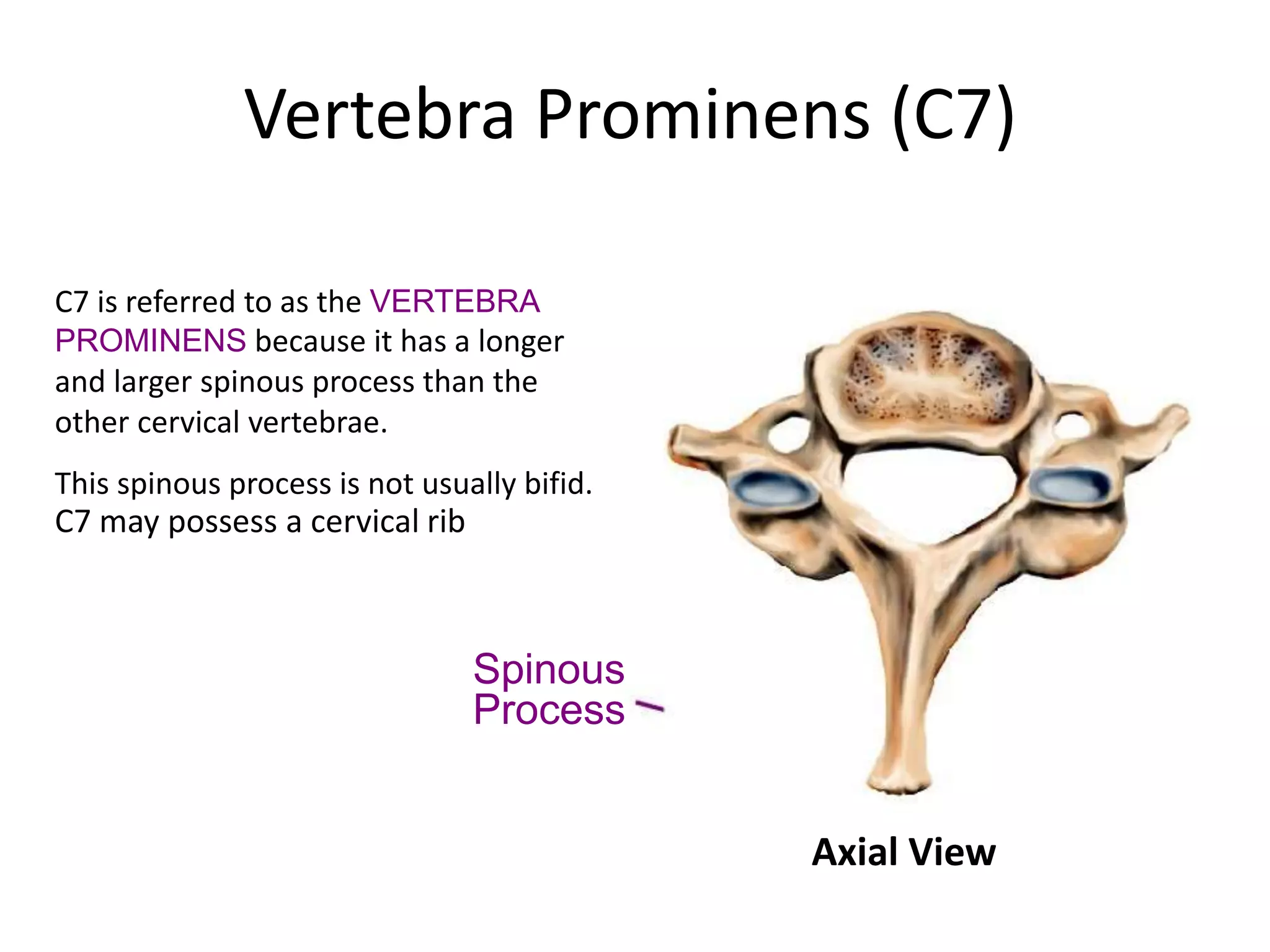 Anatomy Of Cervical Spine Ppt