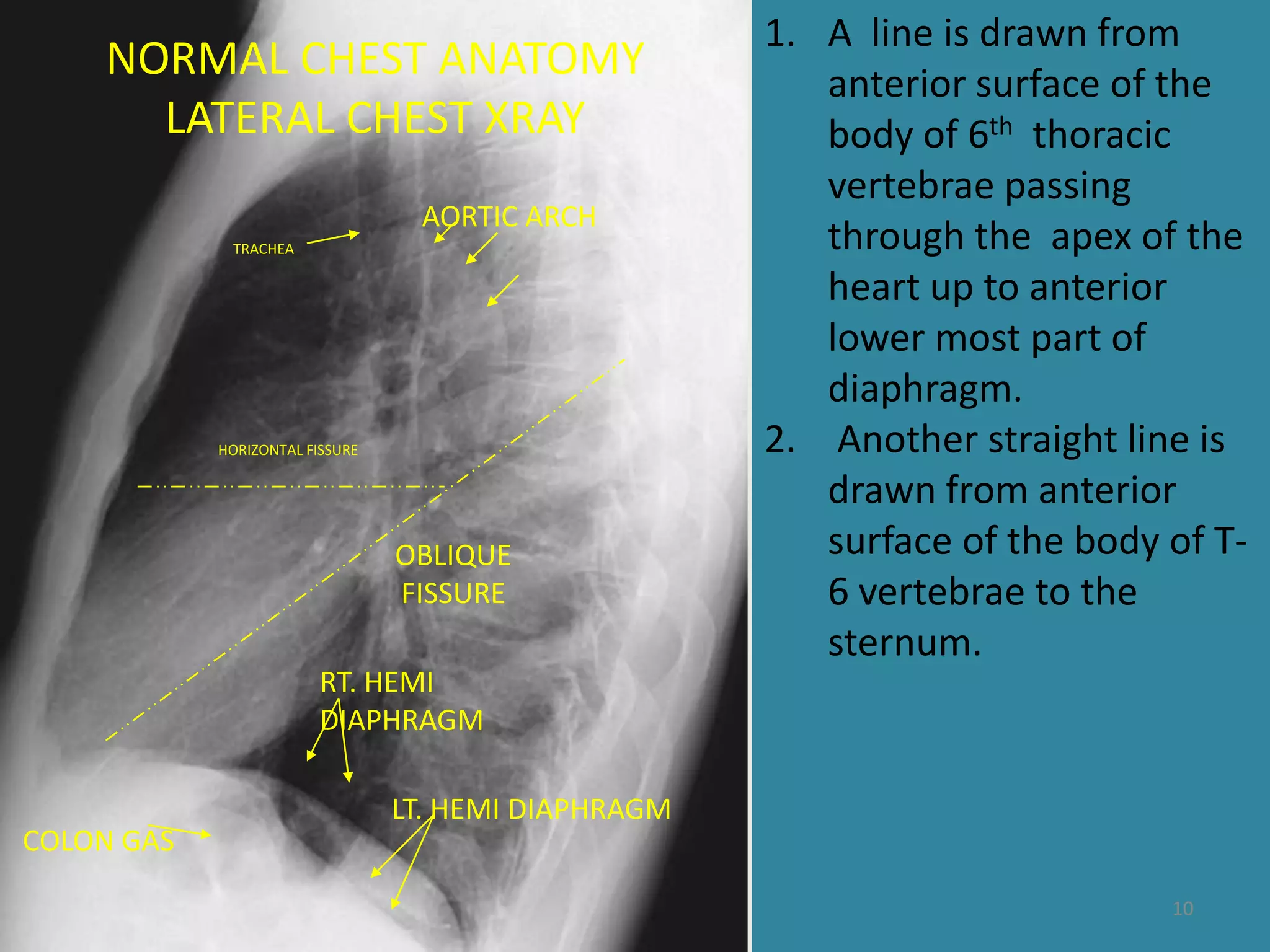 Anatomy of chest | PPTX