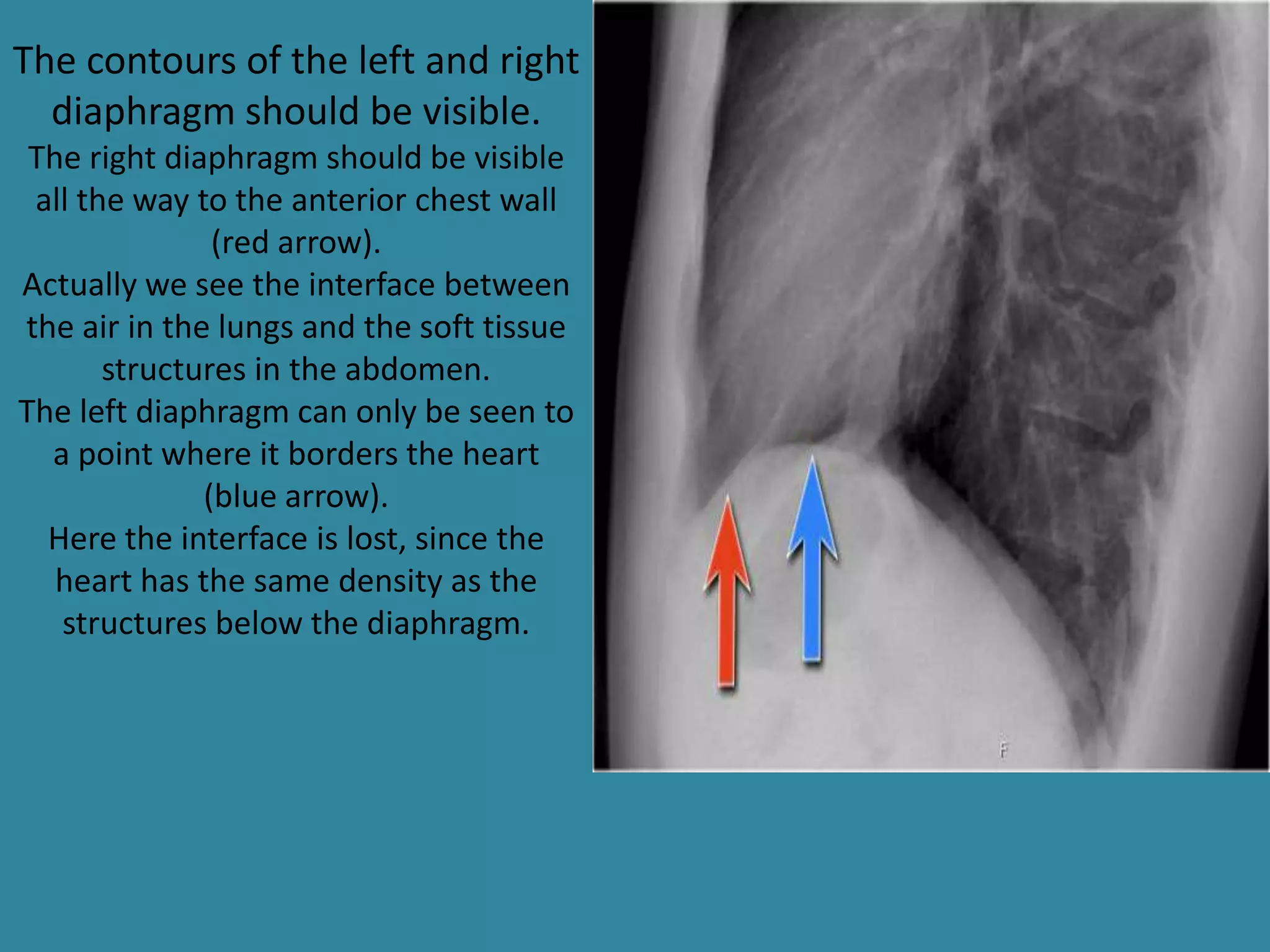 Anatomy of chest | PPTX