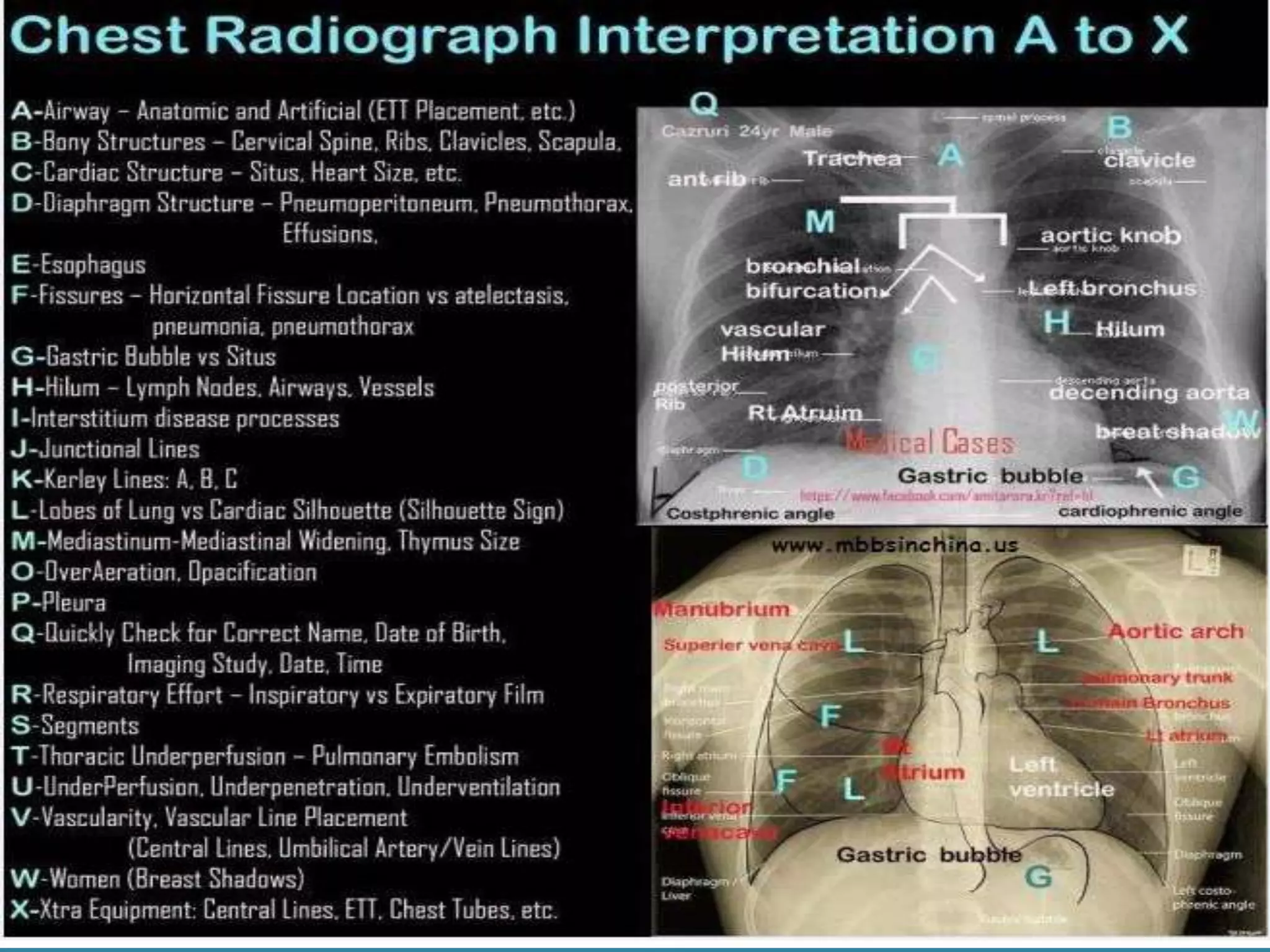 Anatomy of chest | PPTX