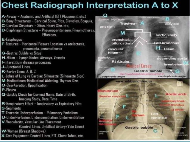 Anatomy of chest | PPTX