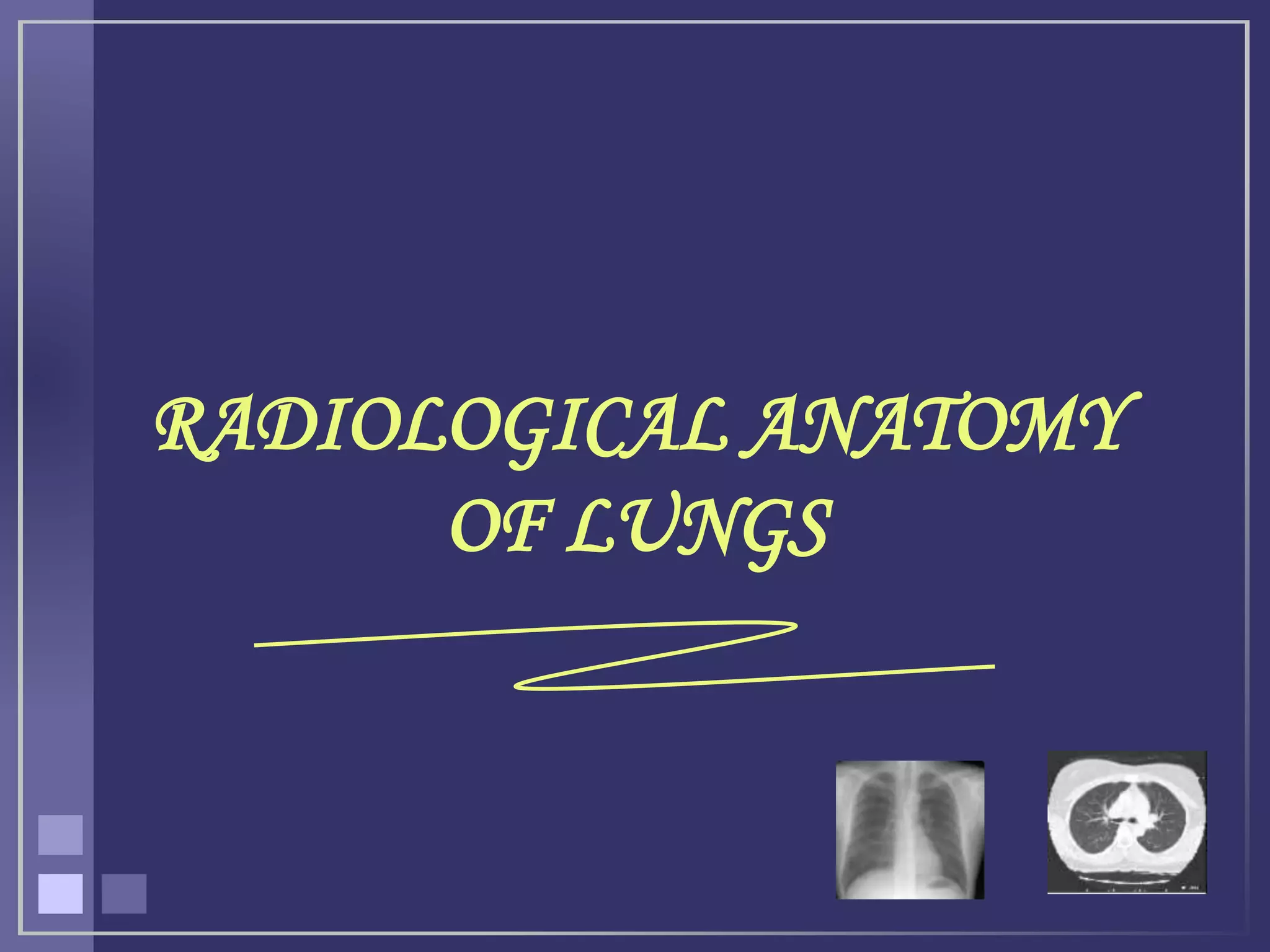 radiology anatomy of chest.ppt