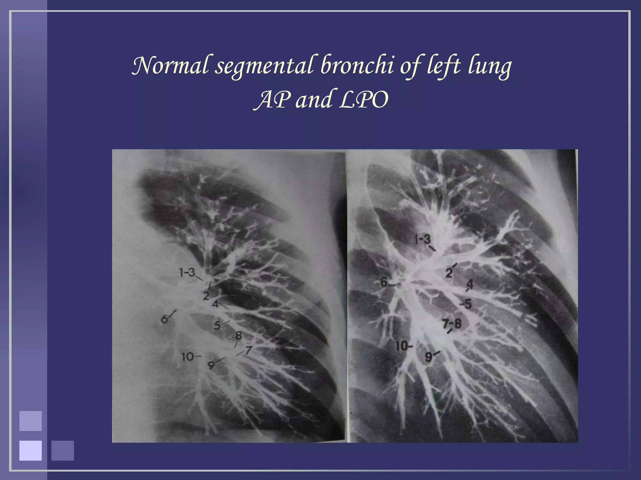 radiology anatomy of chest.ppt