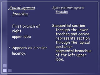 radiology anatomy of chest.ppt