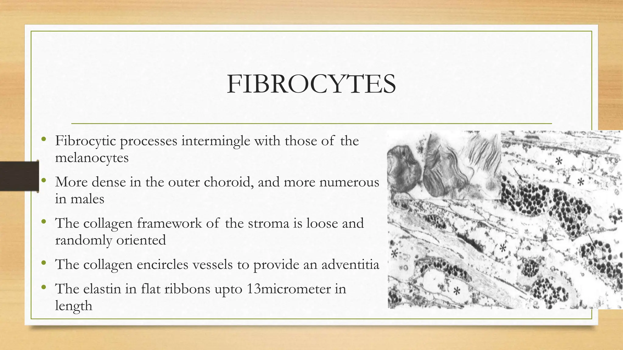 ANATOMY OF CHOROID.pptx