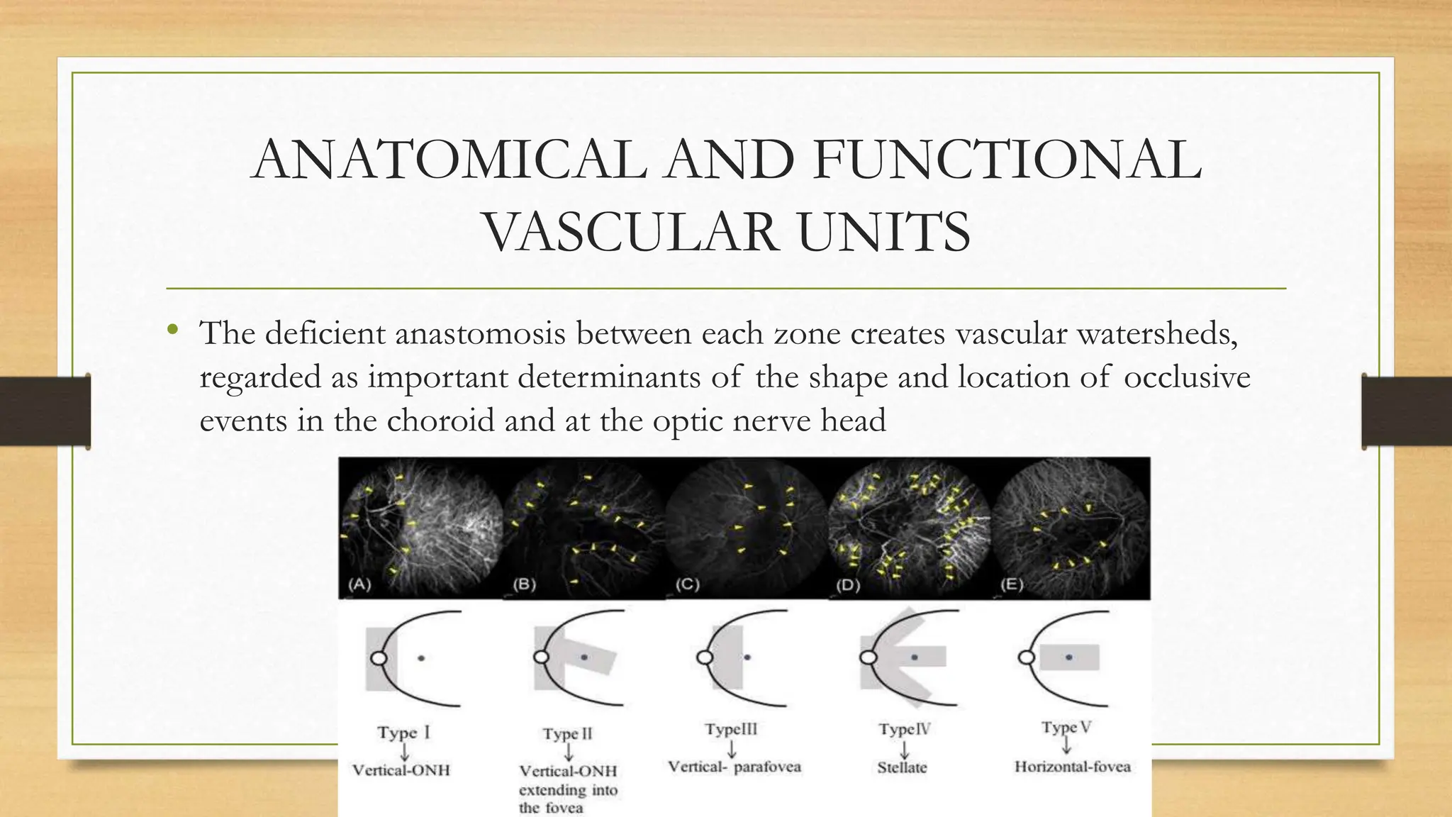 ANATOMY OF CHOROID.pptx