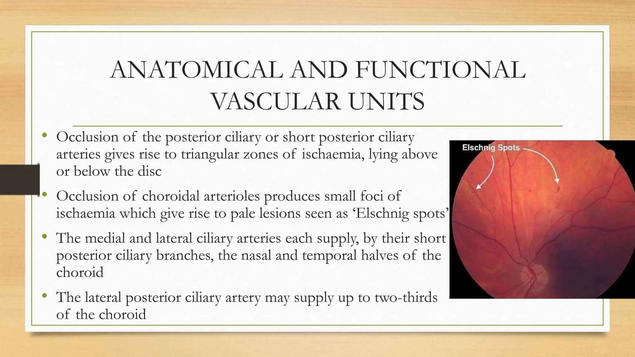 ANATOMY OF CHOROID.pptx