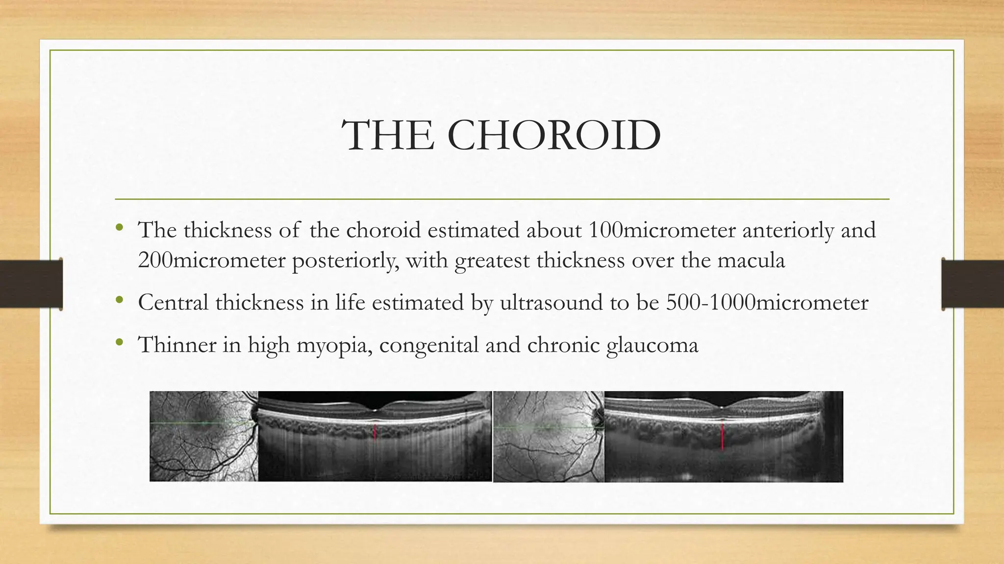 ANATOMY OF CHOROID.pptx