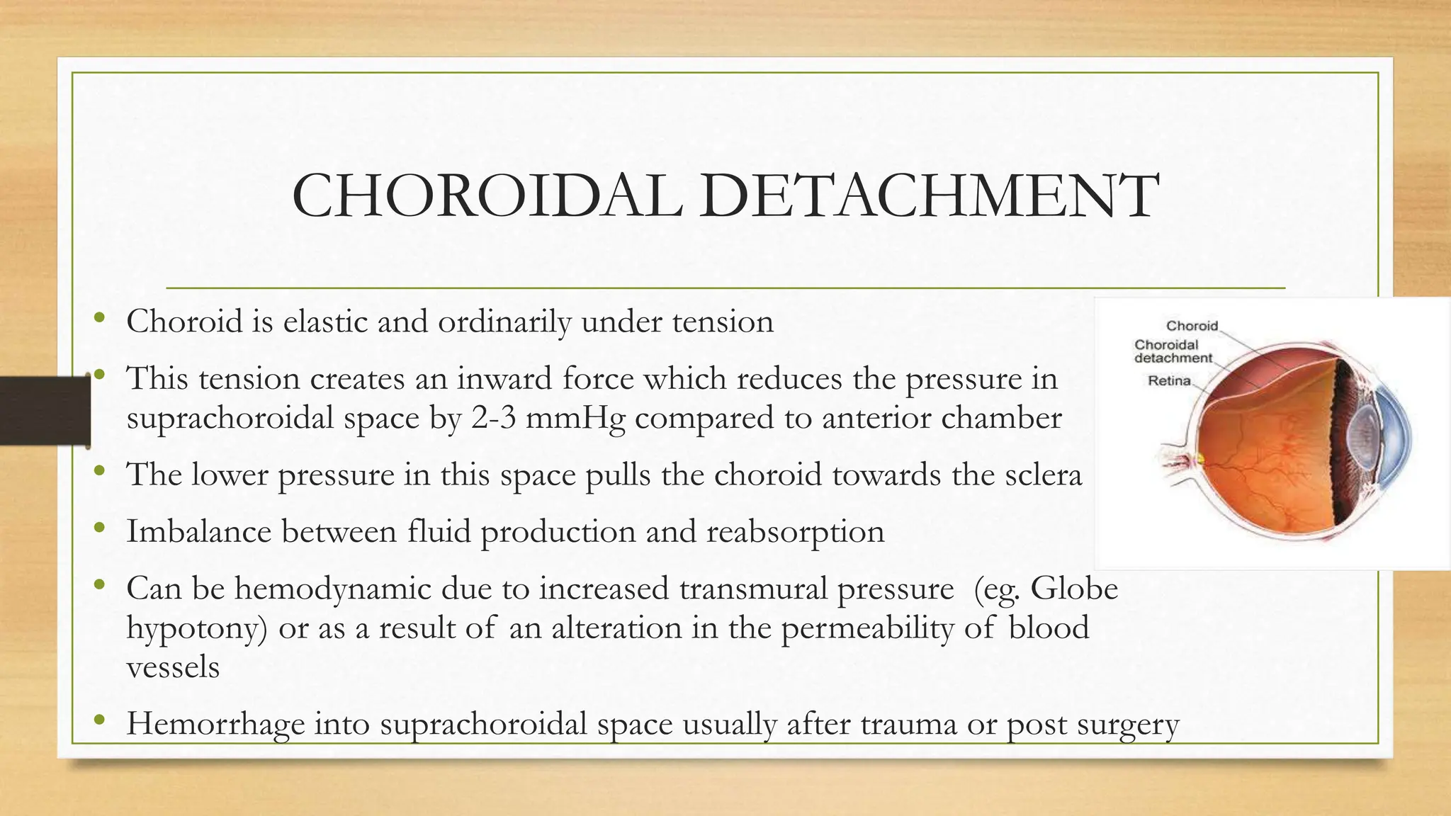 ANATOMY OF CHOROID.pptx