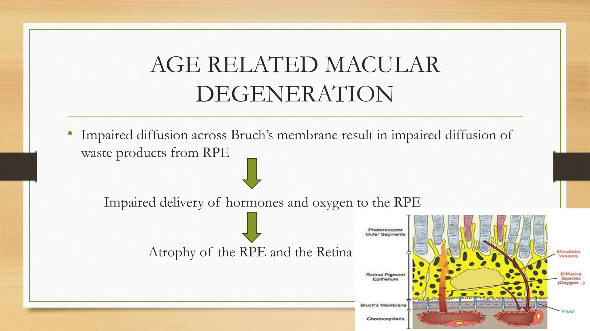 ANATOMY OF CHOROID.pptx