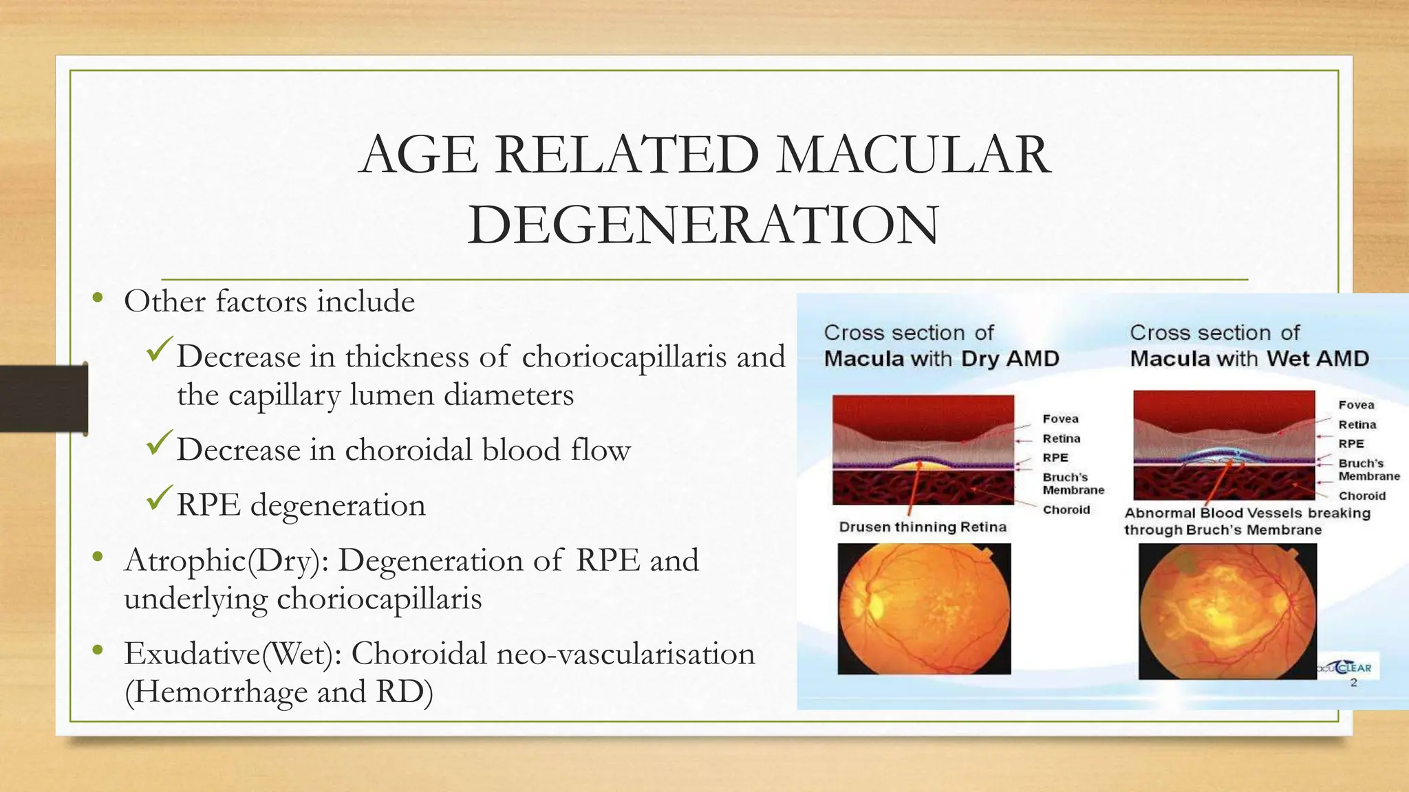 ANATOMY OF CHOROID.pptx
