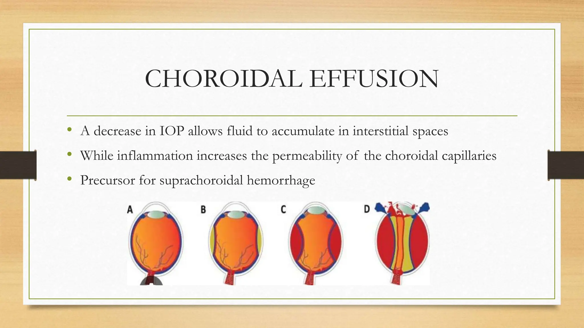 ANATOMY OF CHOROID.pptx