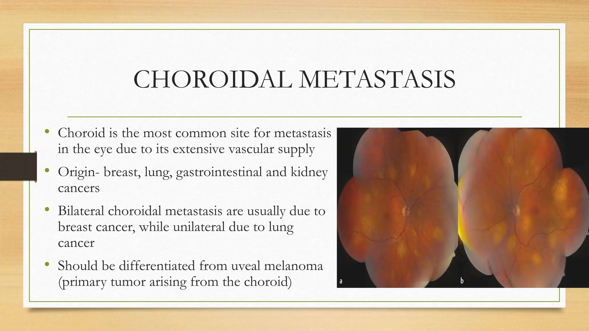 ANATOMY OF CHOROID.pptx