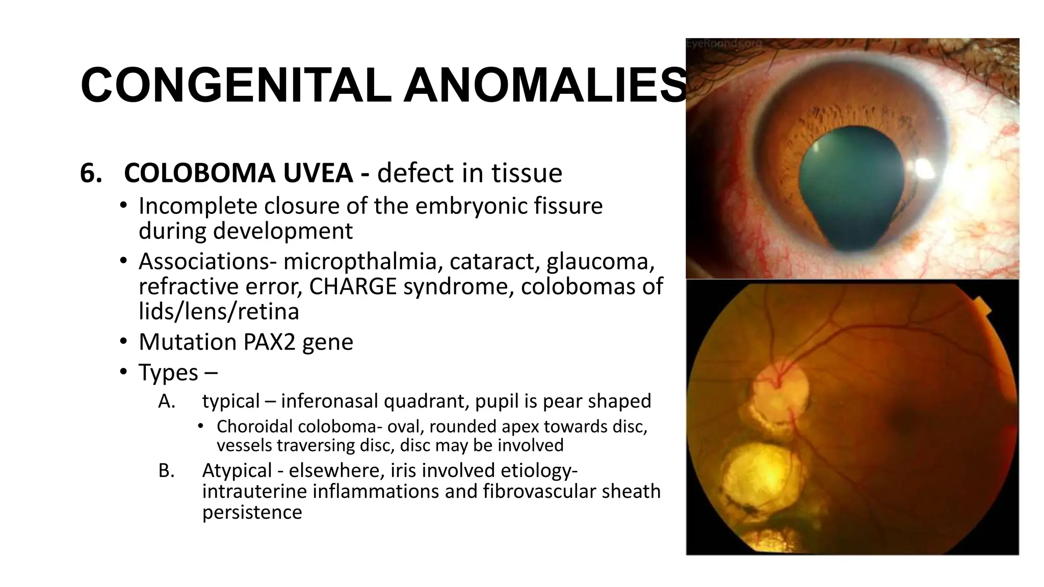 ANATOMY OF CILIARY BODY, IRIS AND CHOROID.ppt