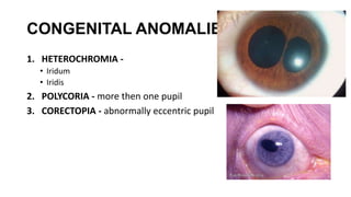 ANATOMY OF CILIARY BODY, IRIS AND CHOROID.ppt