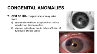 ANATOMY OF CILIARY BODY, IRIS AND CHOROID.ppt