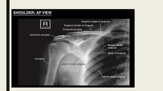 Anatomy Of Clavicle Normal copy (1) (1).pptx