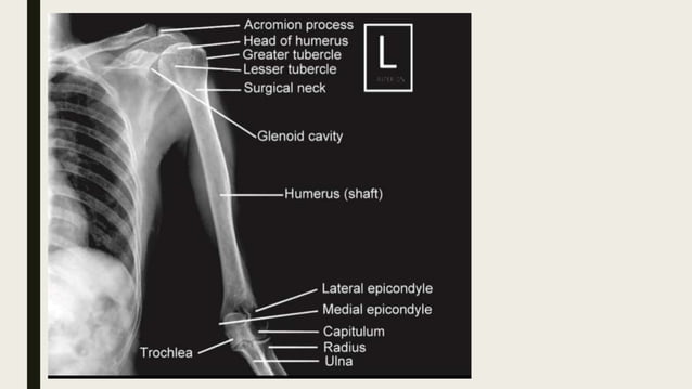 Anatomy Of Clavicle Normal copy (1) (1).pptx
