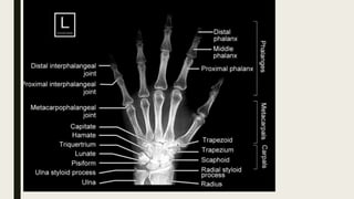 Anatomy Of Clavicle Normal copy (1) (1).pptx