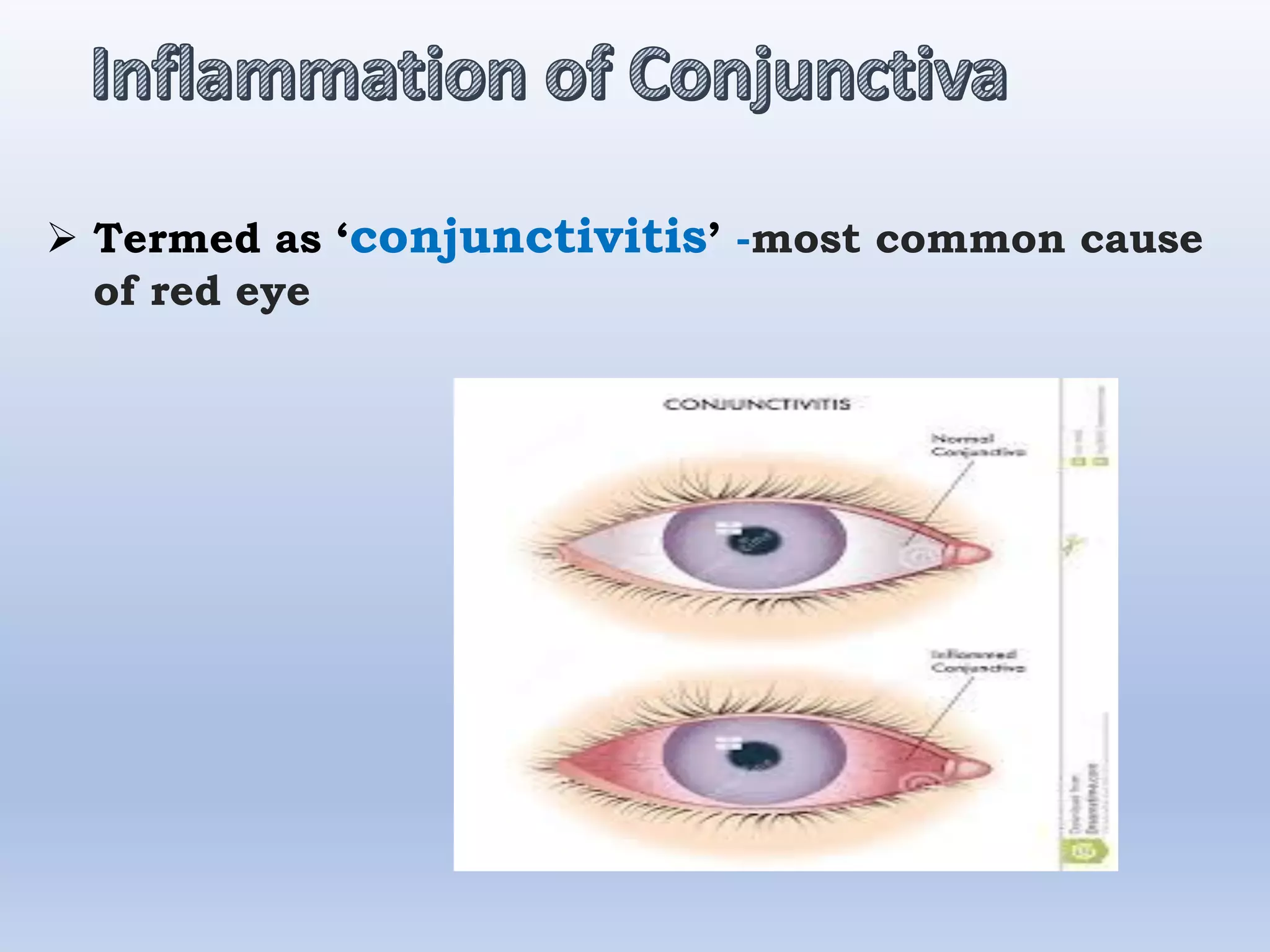 Anatomy of conjunctiva | PDF