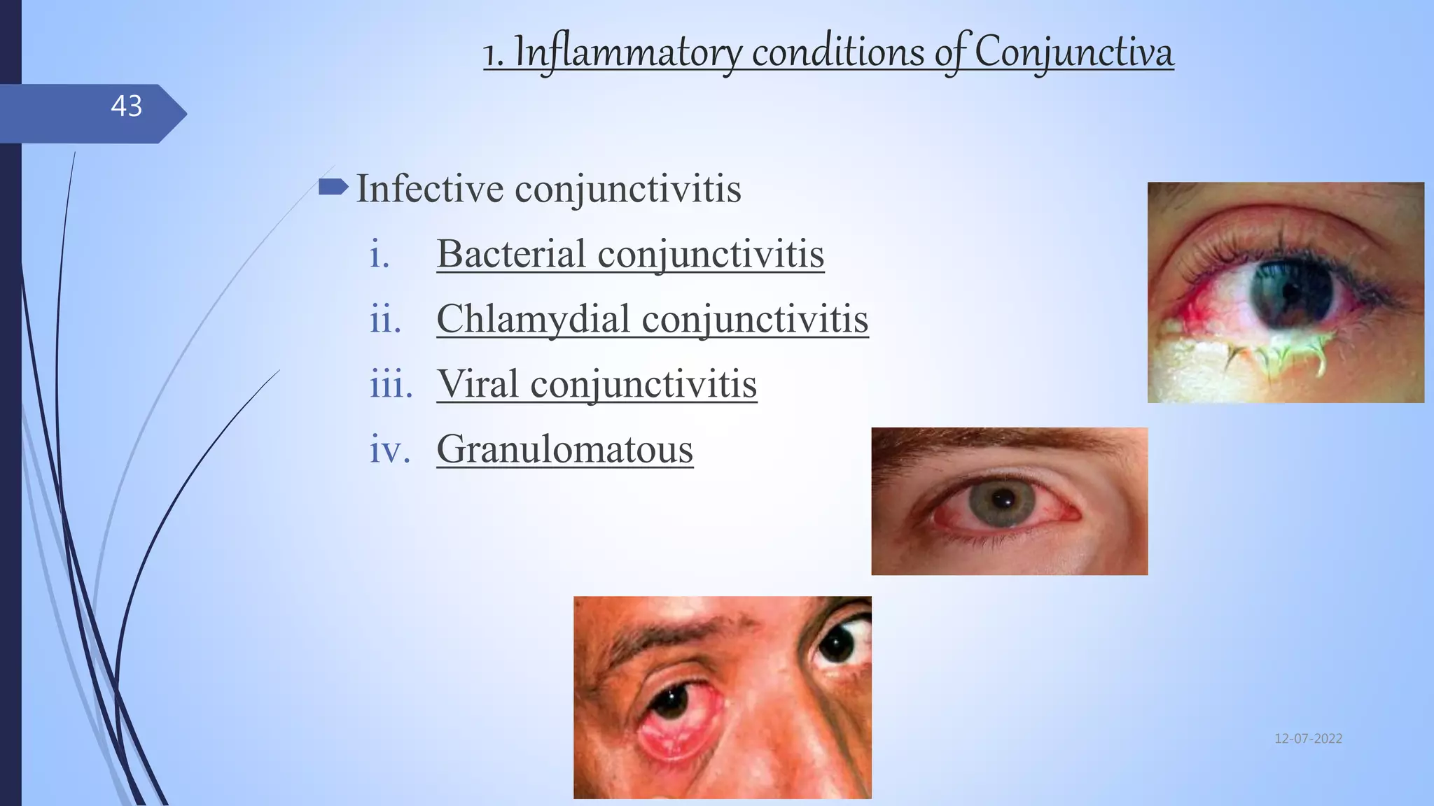 Anatomy of Conjunctiva.pptx
