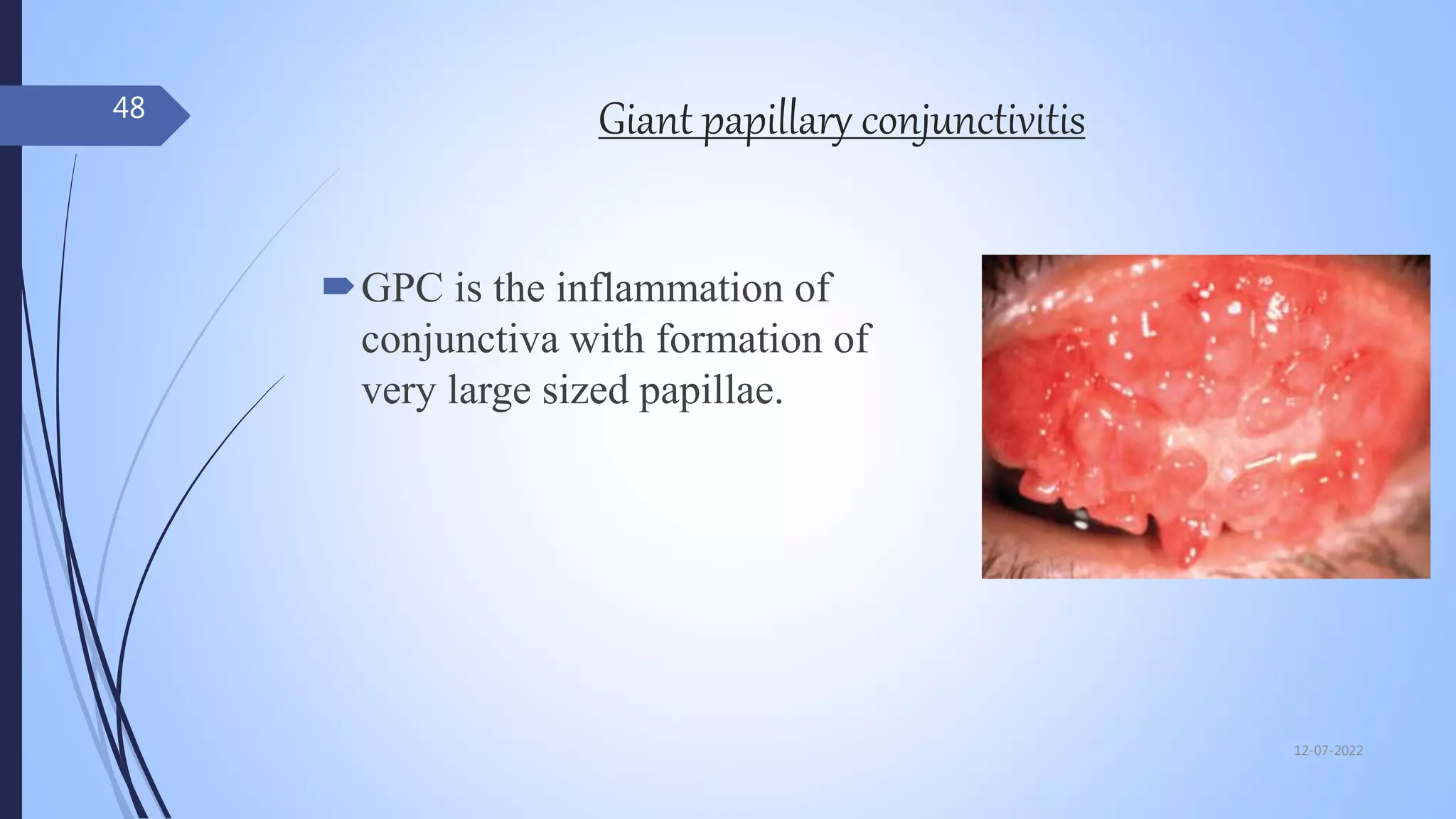 Anatomy of Conjunctiva.pptx