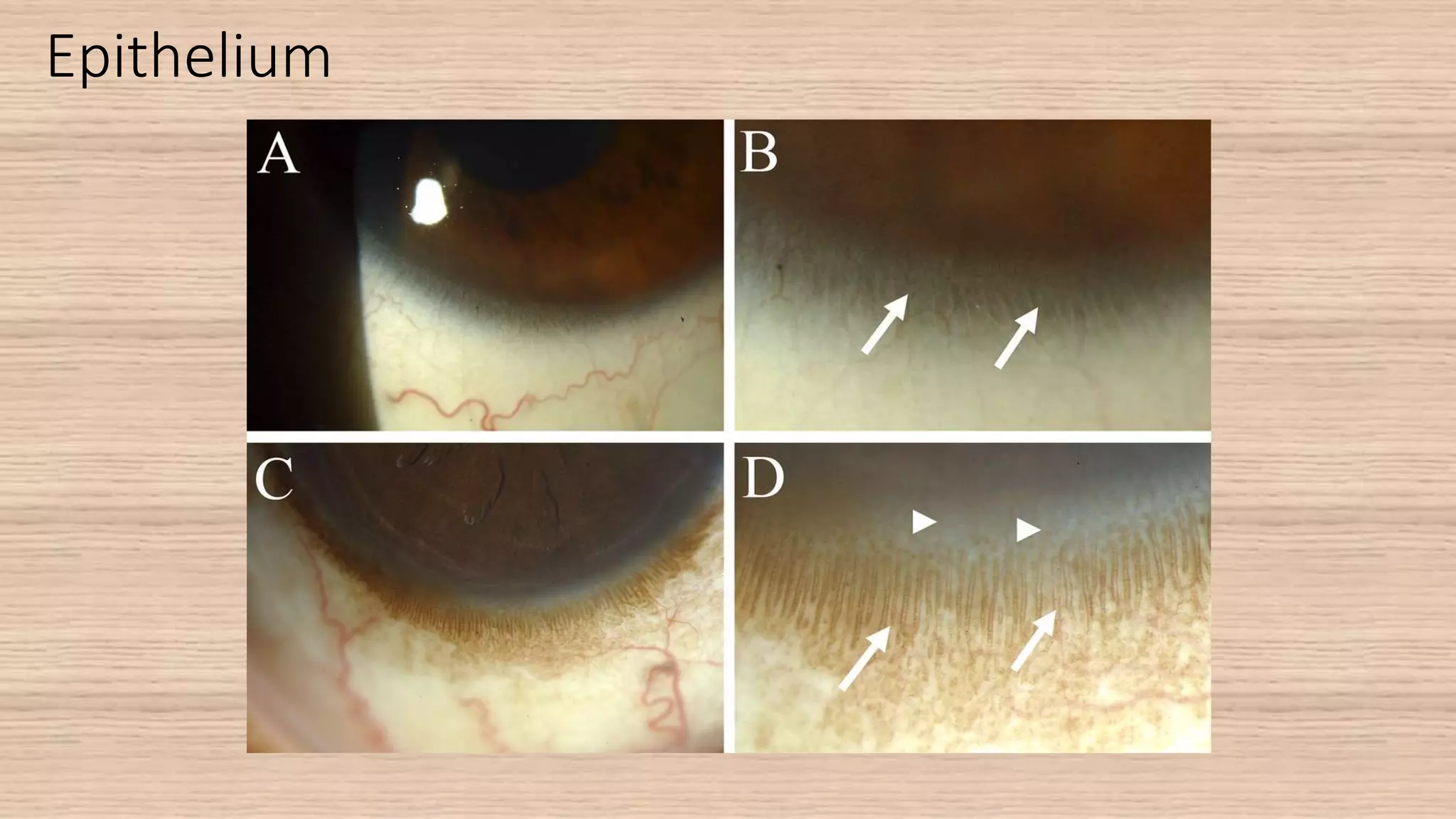 Anatomy of Conjunctiva.pptx
