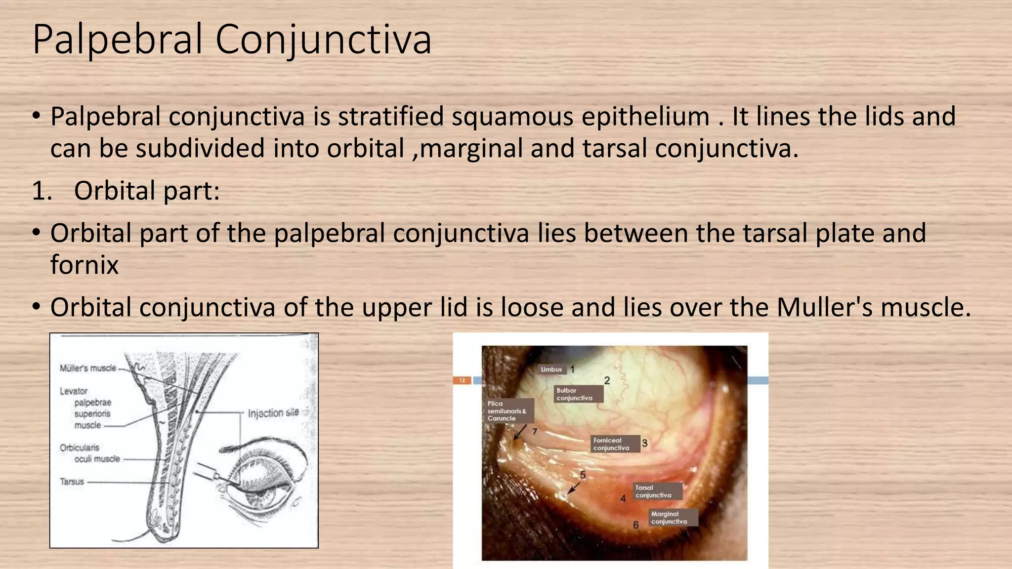 Anatomy of Conjunctiva.pptx