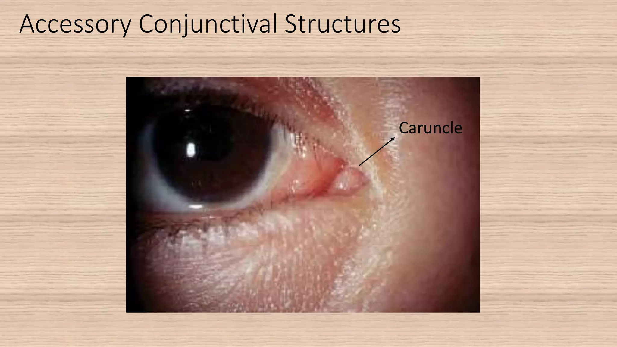 Anatomy of Conjunctiva.pptx