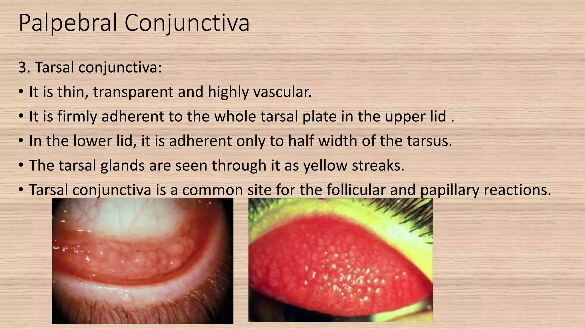 Anatomy of Conjunctiva.pptx