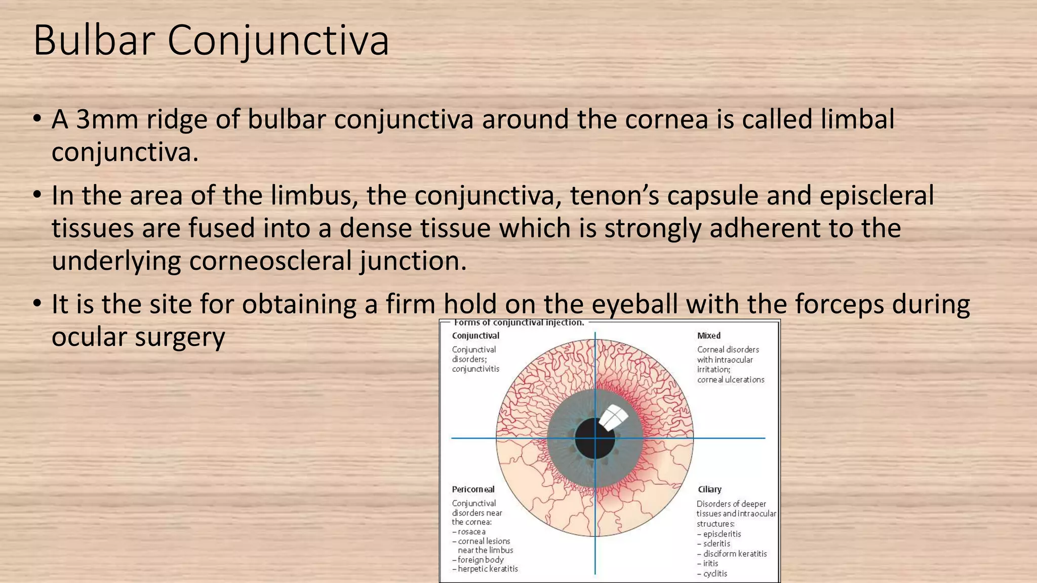 Anatomy of Conjunctiva.pptx