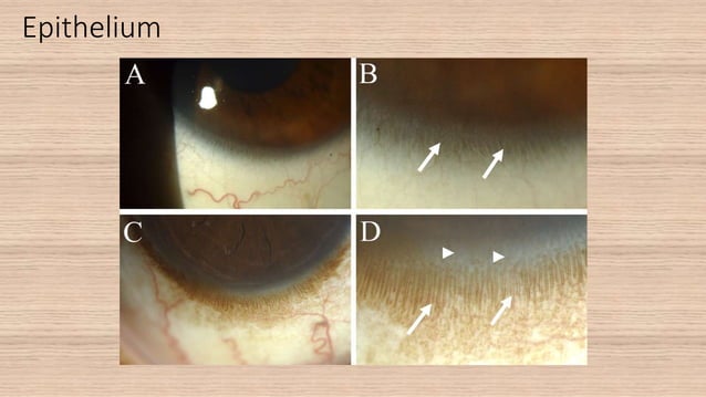 Anatomy of Conjunctiva.pptx | Eye and Vision Conditions | Diseases and ...