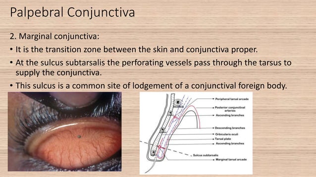 Anatomy of Conjunctiva.pptx | Eye and Vision Conditions | Diseases and ...