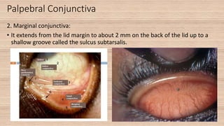 Anatomy of Conjunctiva.pptx