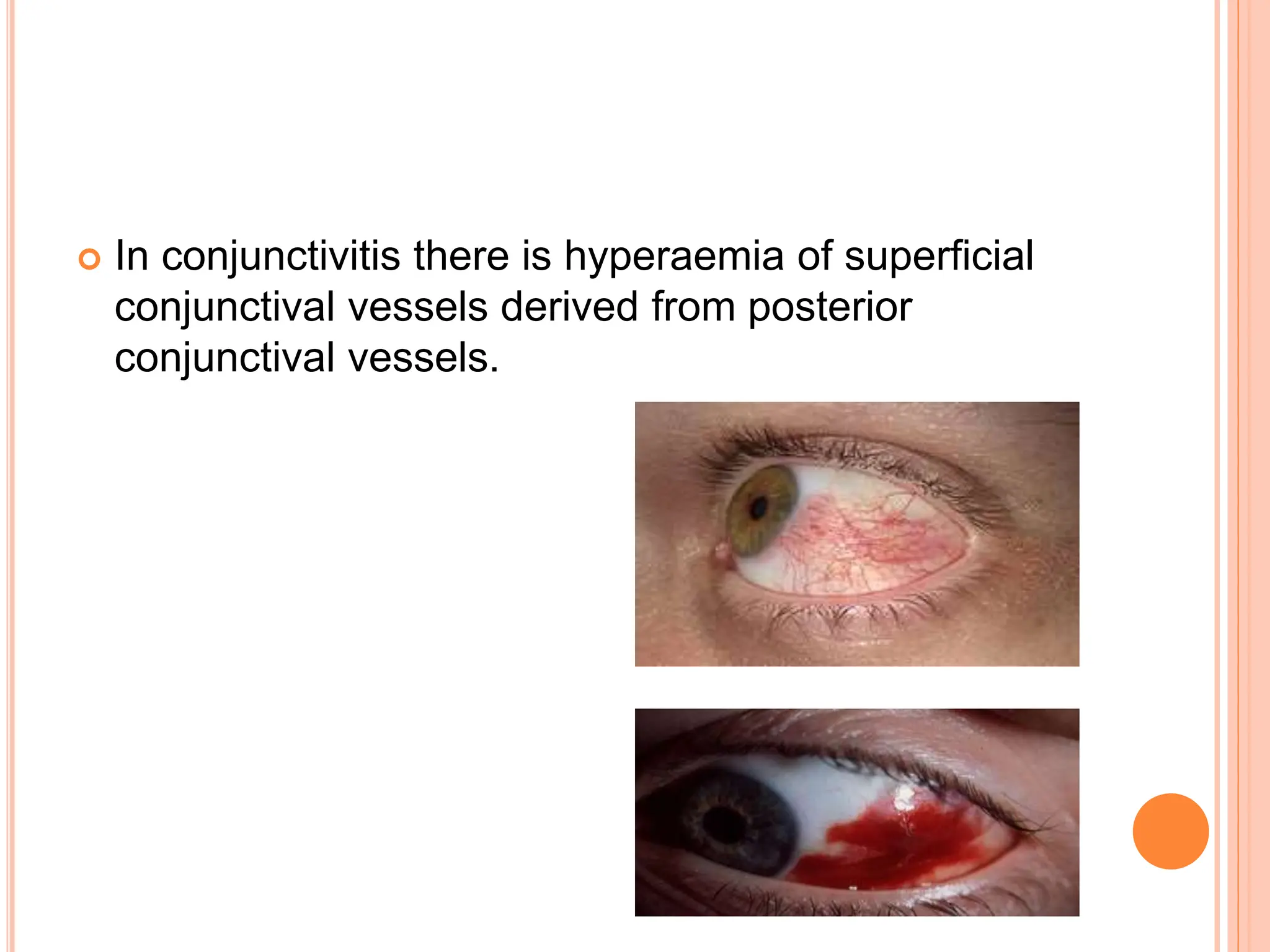 anatomy and pathophysiology of conjunctiva.pptx